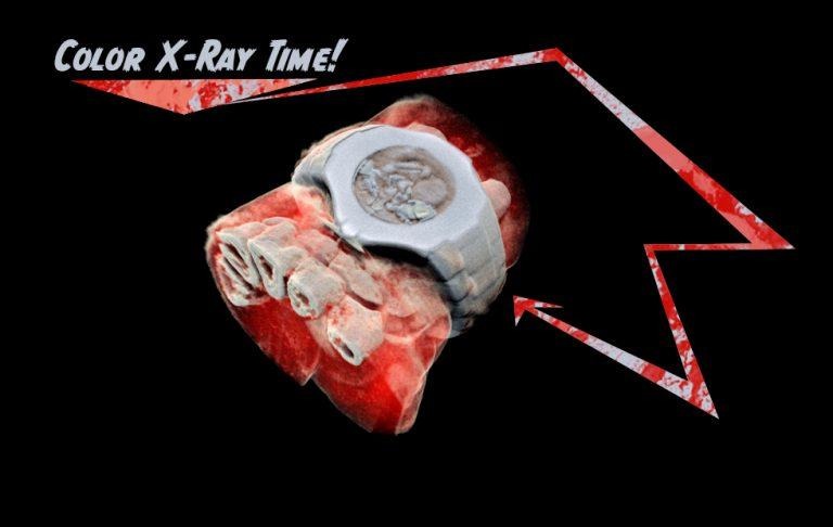 看哪，3D 彩色 X 射线：火星扫描仪，采用 CERN 技术制造 - Wwtyrd.com